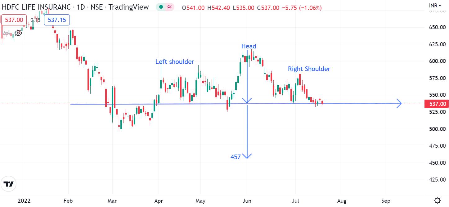 HDFC Life | Head and Shoulder | Latest stock market news