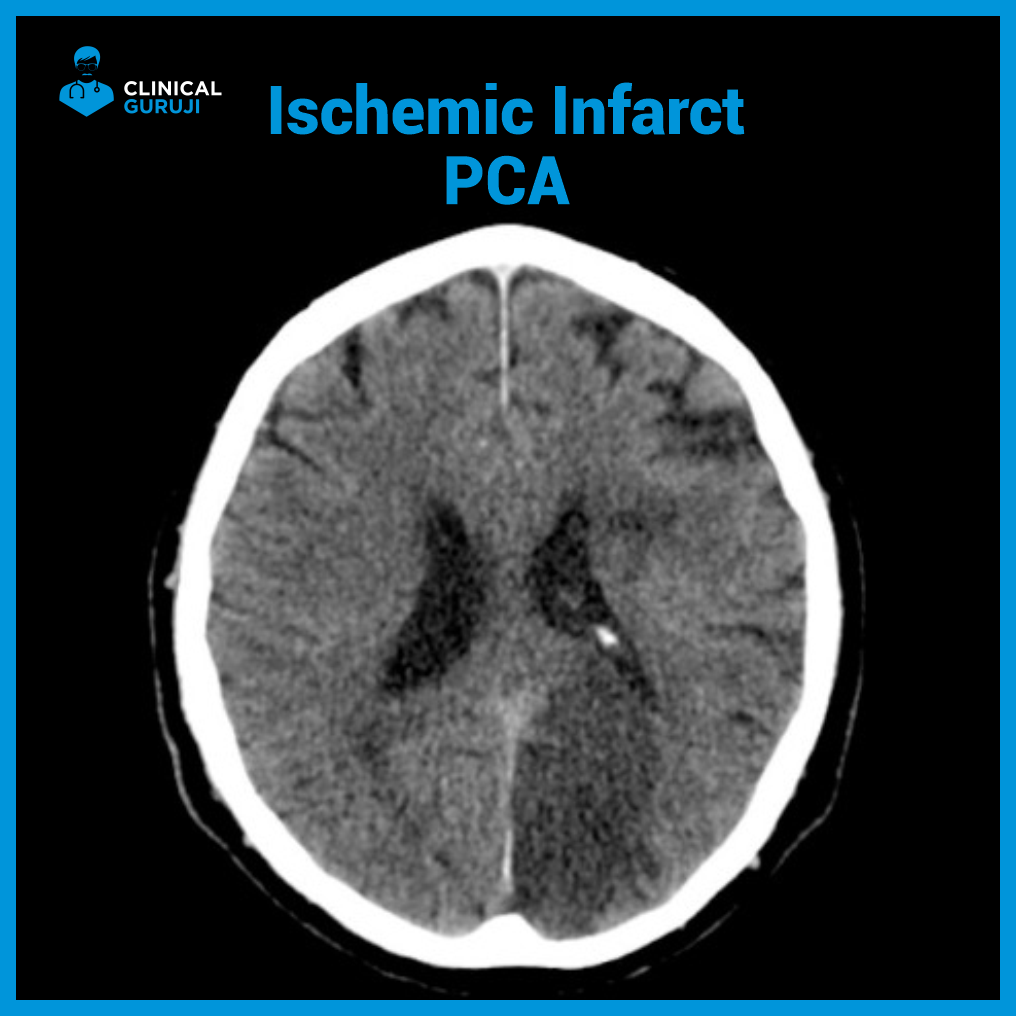 Decoding CT Head Scans: 7 Key Findings for Accurate Diagnoses and ...