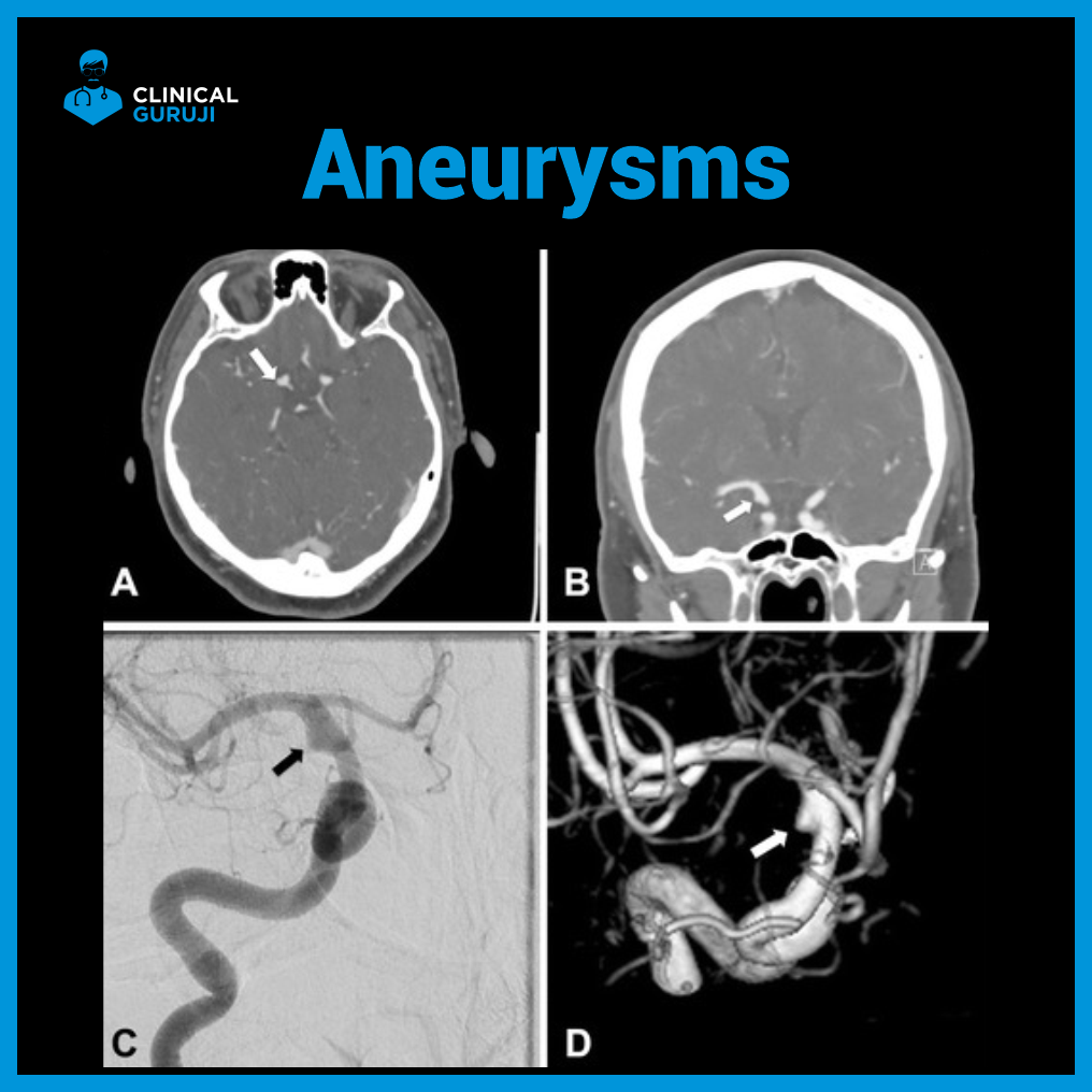 Decoding CT Head Scans: 7 Key Findings for Accurate Diagnoses and ...