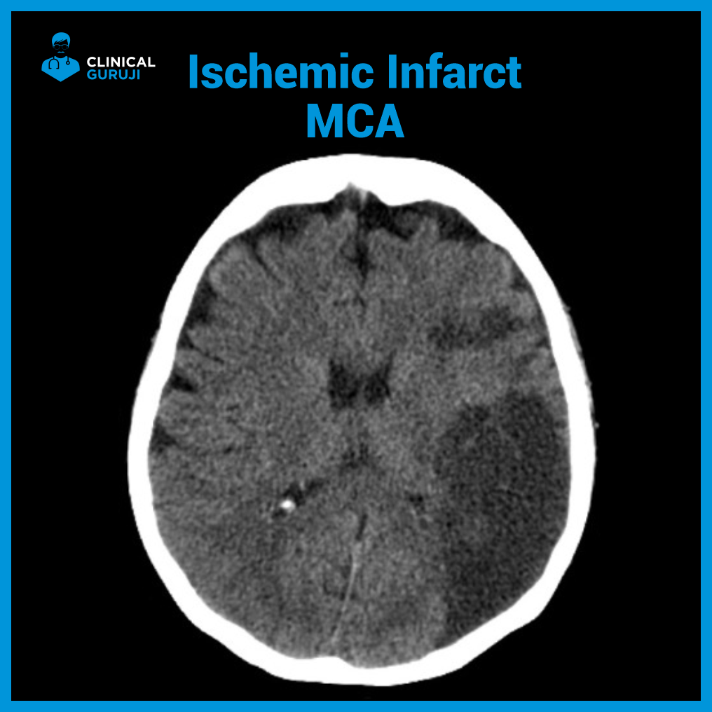 Decoding CT Head Scans: 7 Key Findings for Accurate Diagnoses and ...