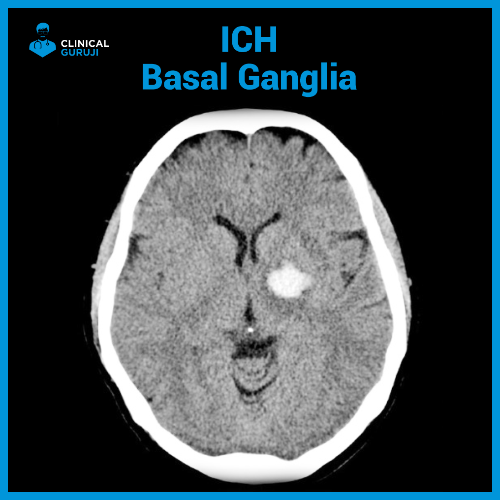 Decoding CT Head Scans: 7 Key Findings for Accurate Diagnoses and ...