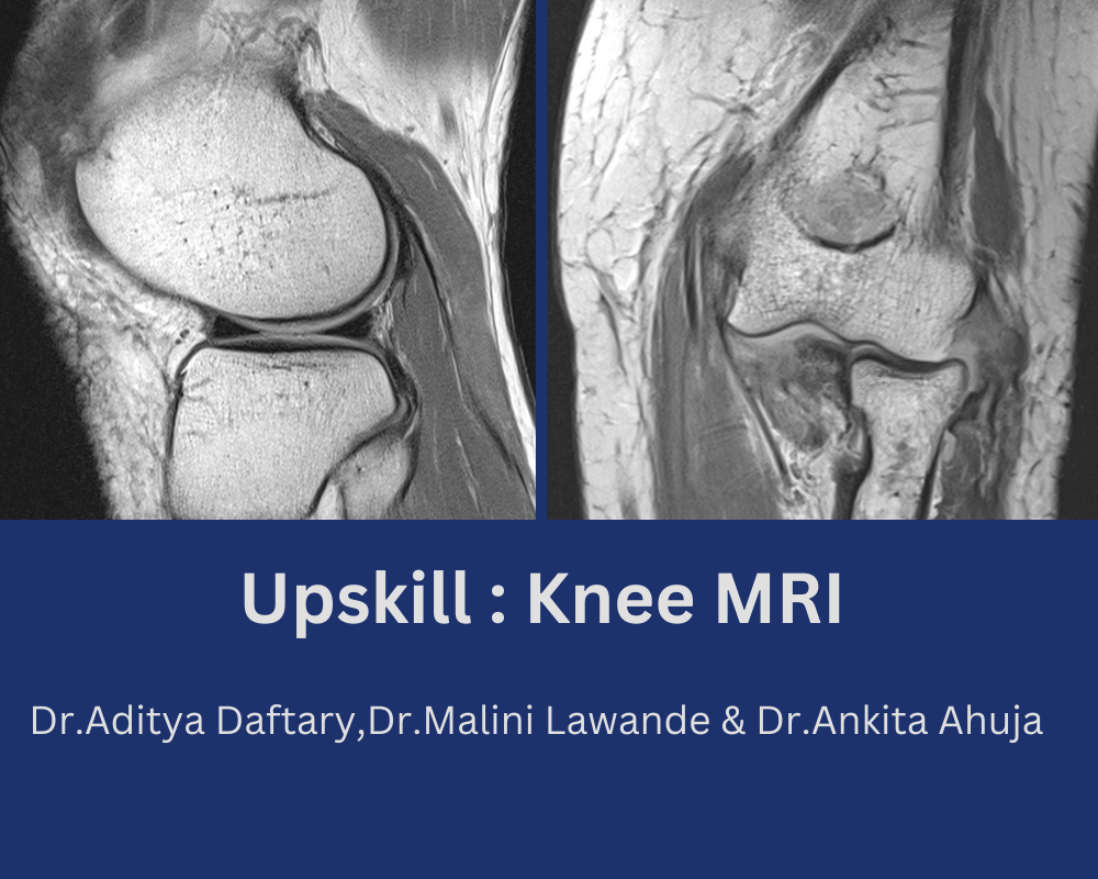 Upskill: Knee MRI
