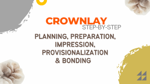 Crownlay: Step-by-Step protocol